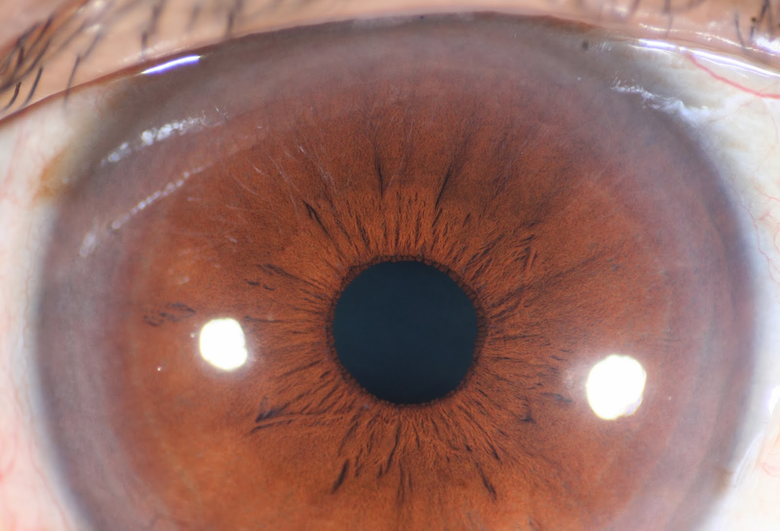 Modern & Multidimensional Iridology: IPB Morphologies, Pupil Flatness ...