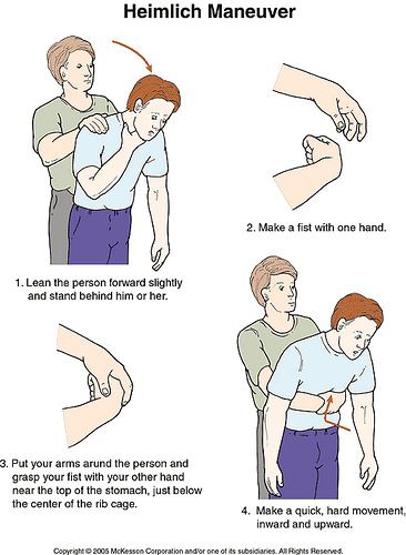 Confessions of ignorance: The Heimlich Maneuver