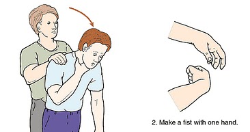 Confessions of ignorance: The Heimlich Maneuver