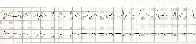 For in that sleep of death what dreams may come...