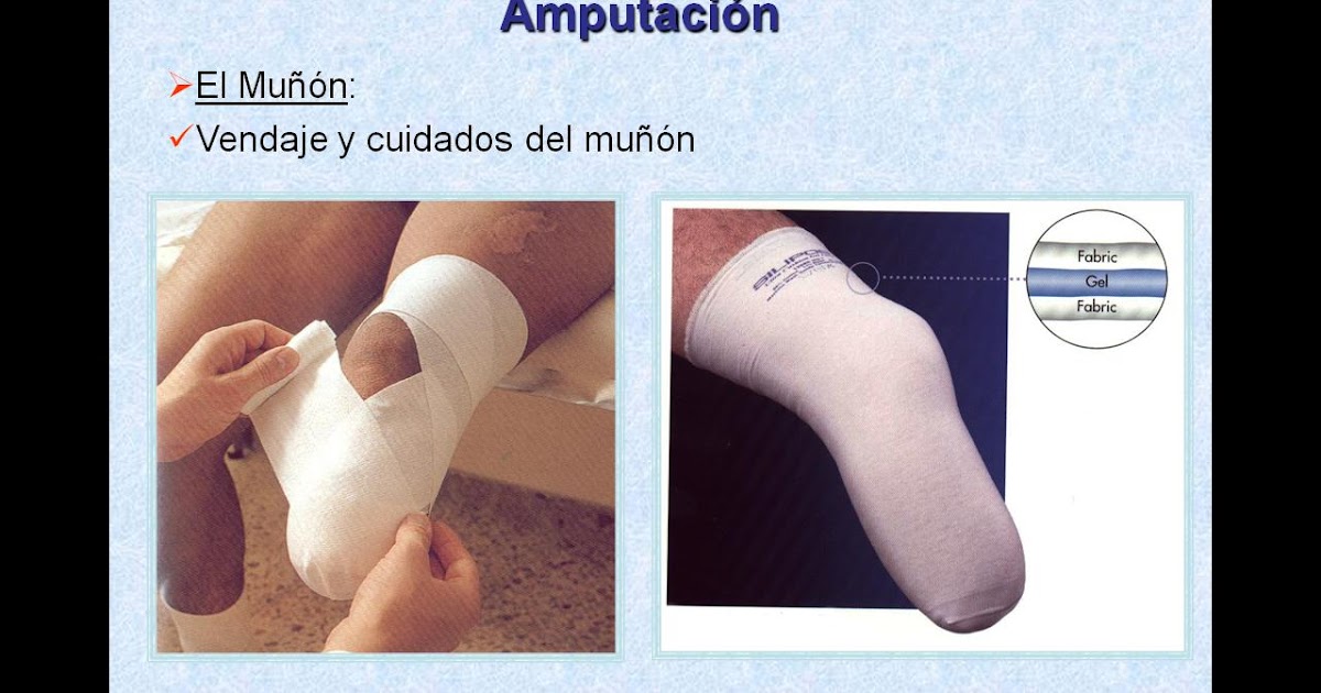 Definición y Fundamentos de Medicina Física y Rehabilitacion