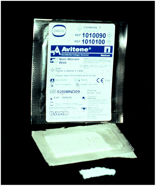 Dentistry and Medicine: Diagnosis and Management of Hemorrhage in Oral ...