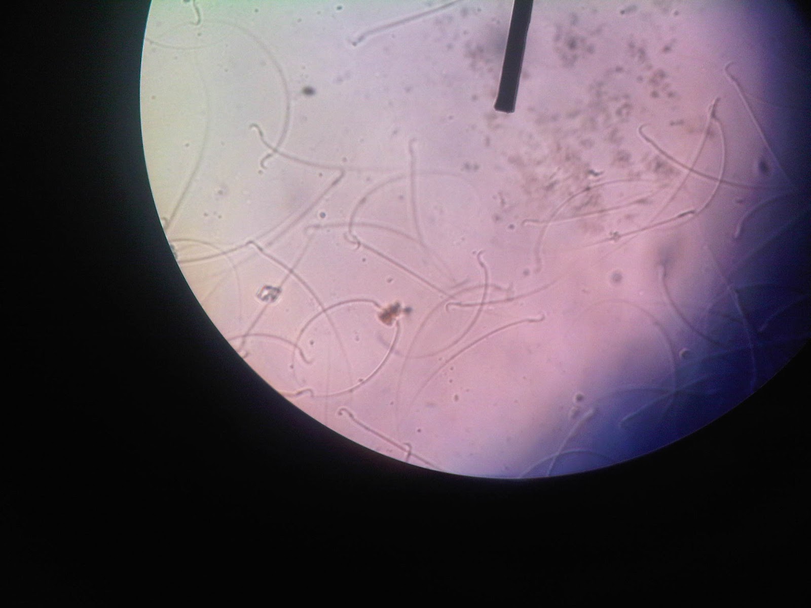 Embriologi Semesta: Spermatozoa