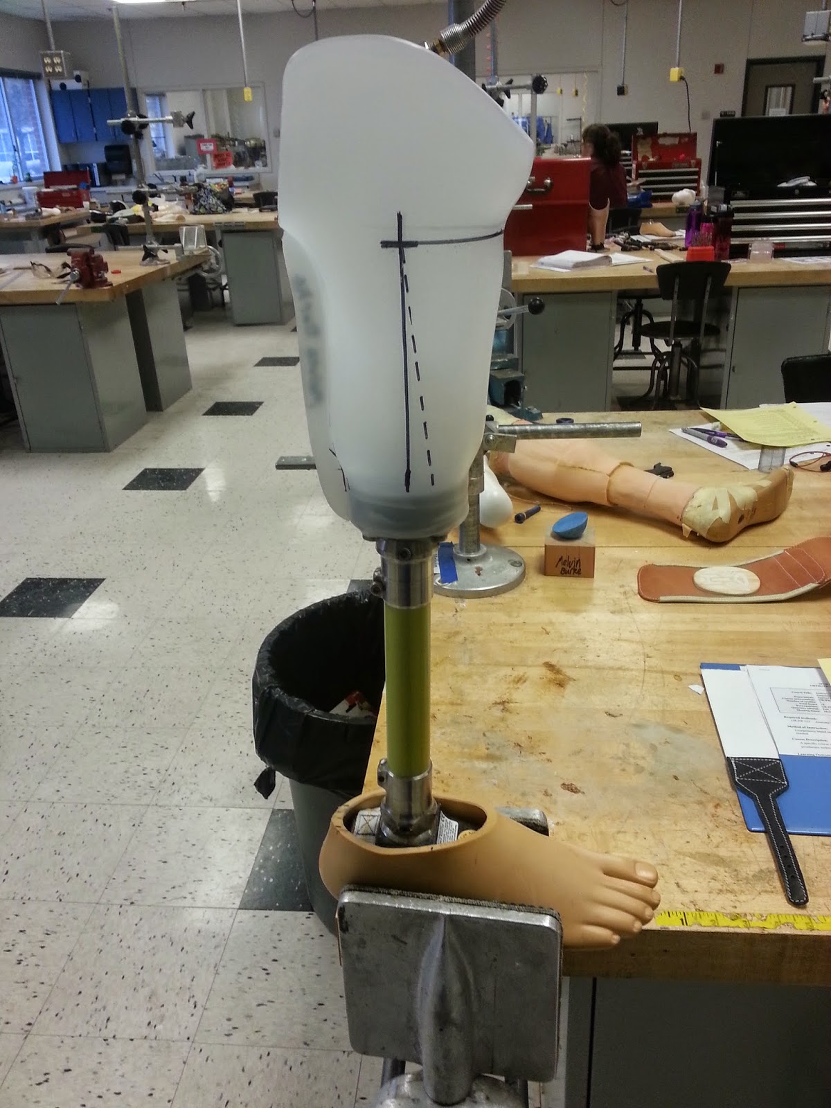 Prosthetic Projects: Locking liner Carbon Fiber transtibial ...