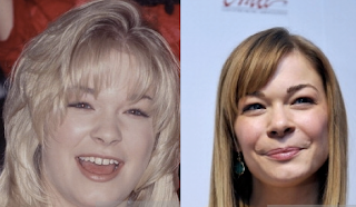 LeAnn Rimes Plastic Surgery