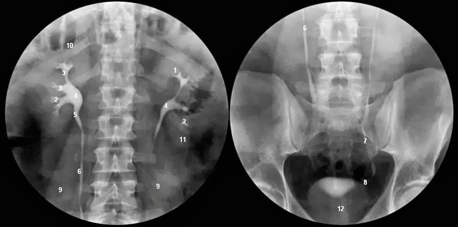 El esfenoides: Anatomía radiológica de la vía urinaria.