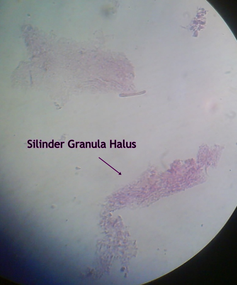 Sedimen Urine Metode Pewarnaan (Stainning) | Analis Kesehatan