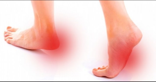 ¿SUFRES DE DOLORES EN LOS TALONES? HE AQUÍ LA MANERA NATURAL DE CURARLO ...