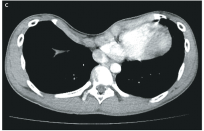 MACAM-MACAM BENTUK DADA | sedjati