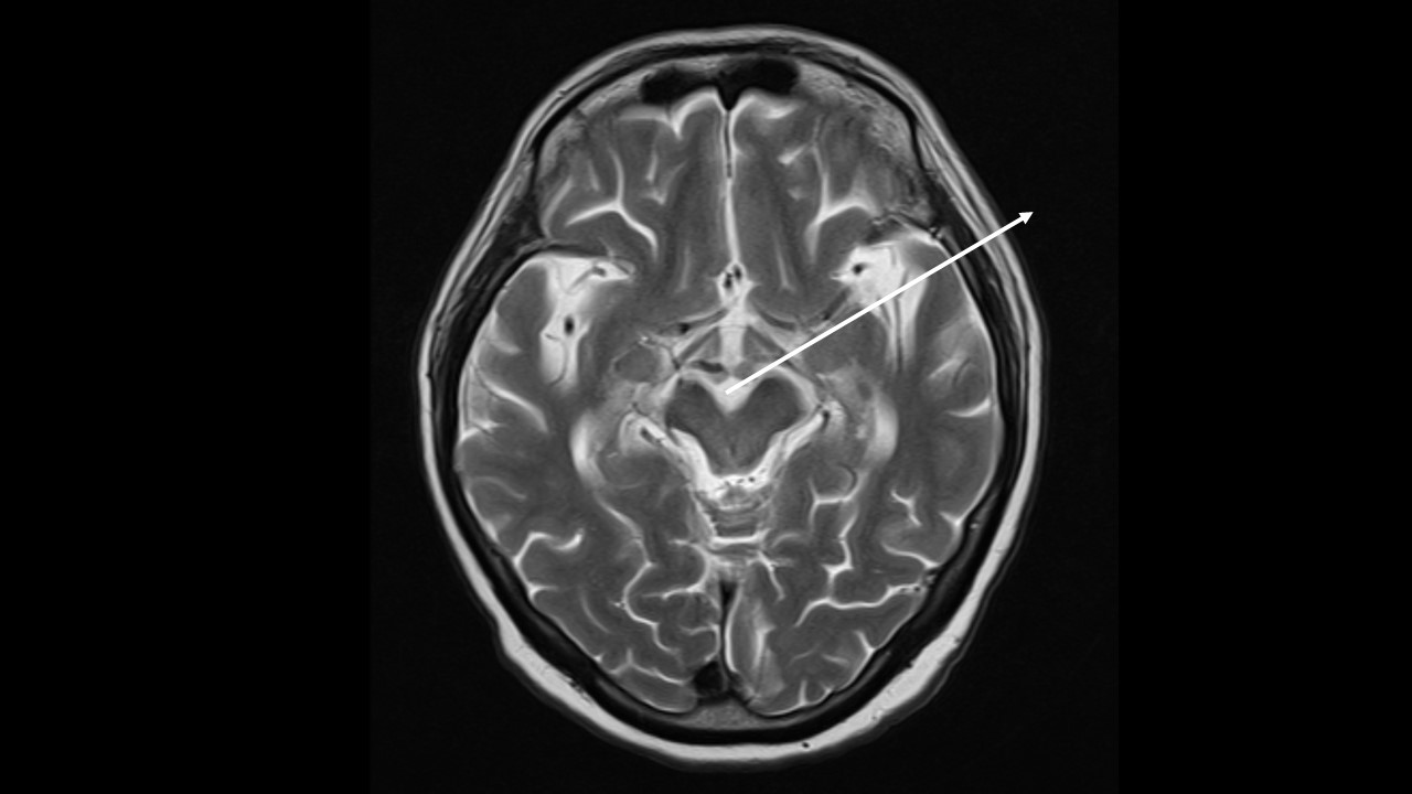Ultimate Radiology : FRCR PART 1 : ANATOMY : 18