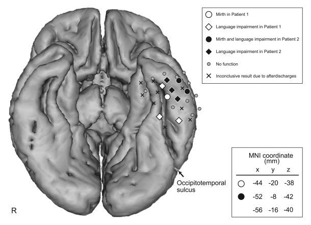 The Neurocritic: Eliciting Mirth and Laughter via Cortical Stimulation