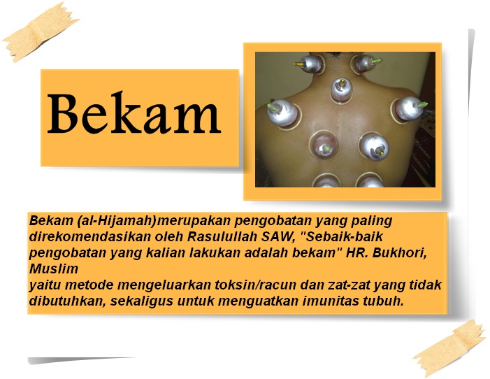 TERAPI BEKAM | BRC (bekam ruqyah center) suci
