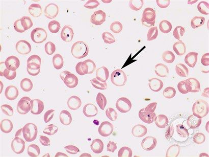 VETERINARY HEMATOLOGY DEXTERVET: pappenheimer bodies