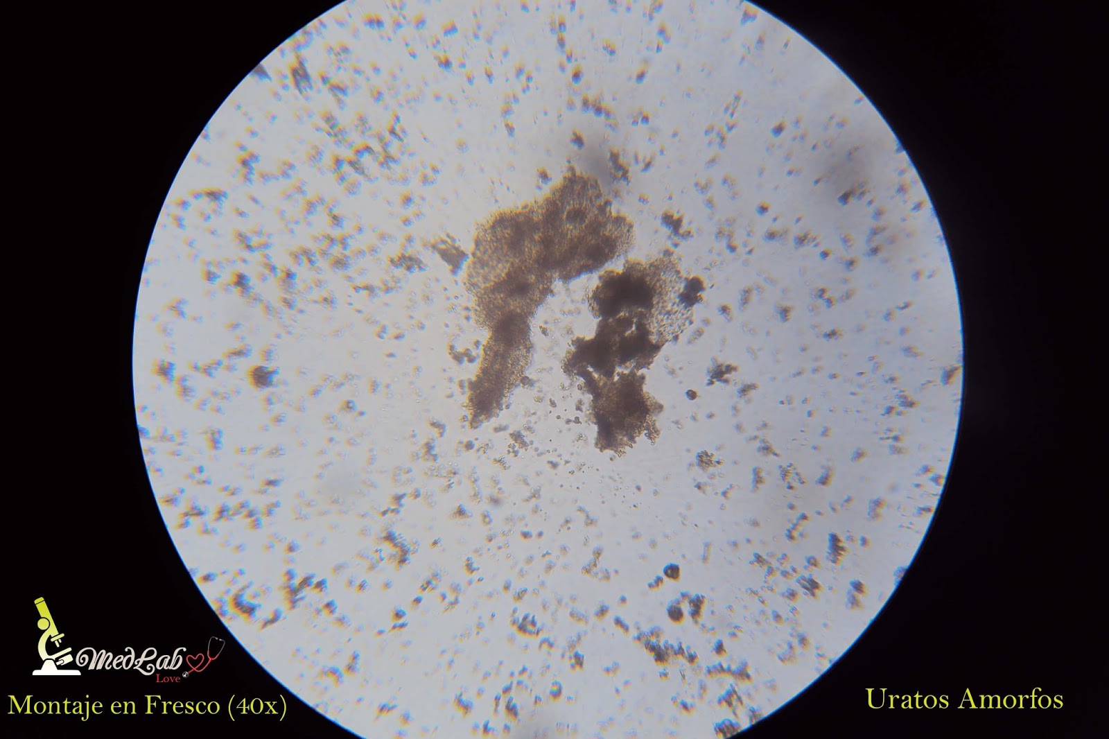 Uratos Amorfos O Que é - RETOEDU