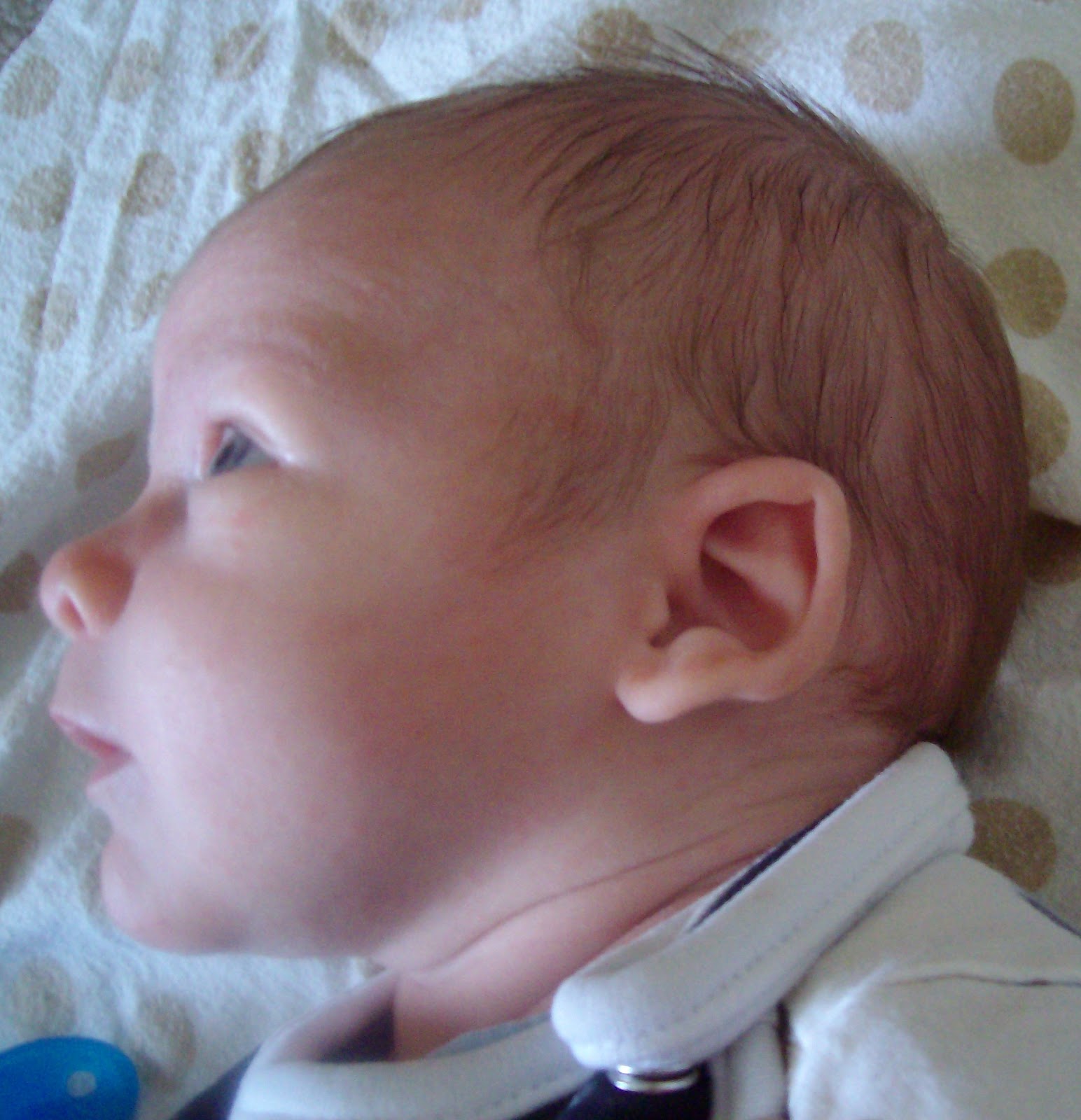 Please, Contain Your Excitement: Elf Ear