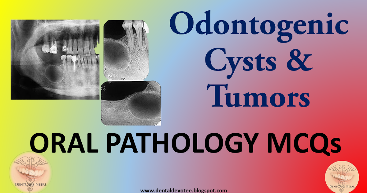 Dentosphere : World of Dentistry: MCQs on Odontogenic Cysts and Tumors ...