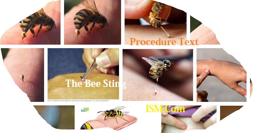 Teks Procedure: How to Cure a Bee sting Versi Inggris Indonesia ...