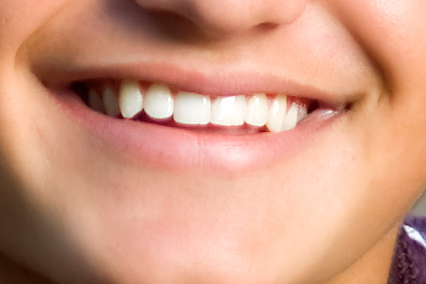 Making it as a Pro: The Science of Smiles