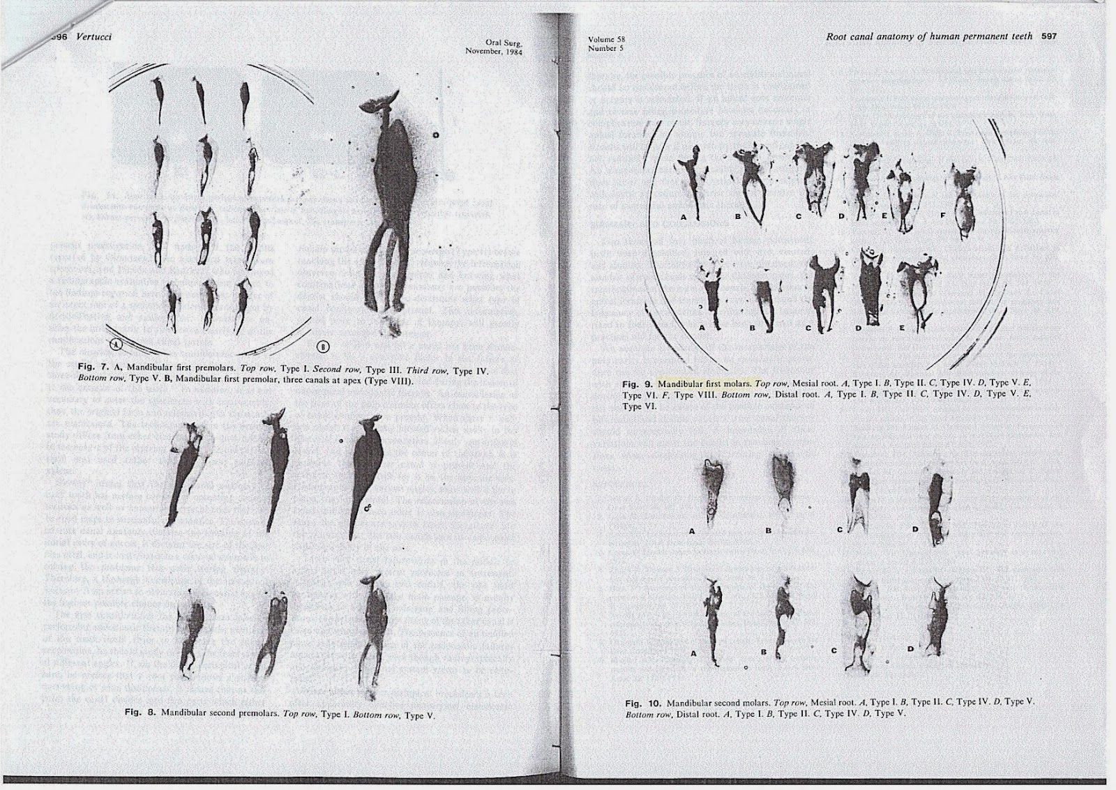 Endodoncia Microscópica en Zaragoza: Root canal anatomy of the human ...