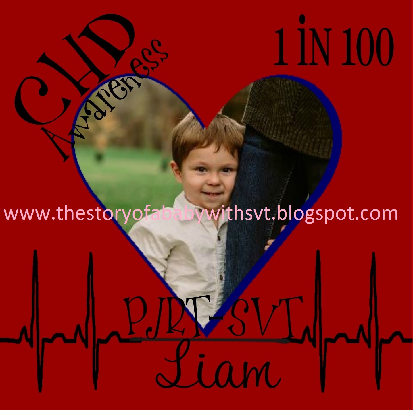 The Story of a Baby with SVT(PJRT): My PJRT Sisters and Brothers