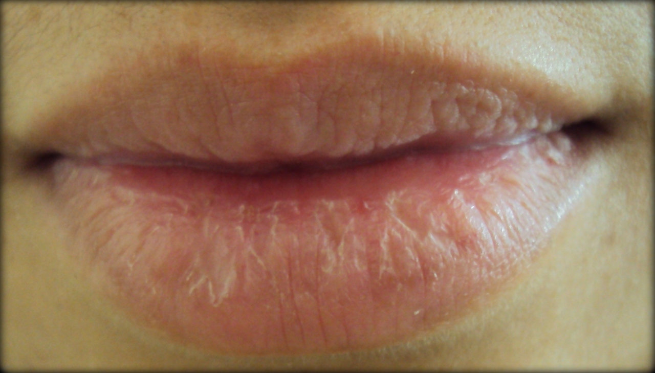 Papo de Esteticista : Sua boca resseca facilmente? Fica descascando ...