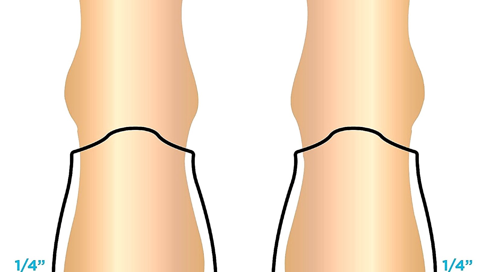 Knee Pain Inside Of Leg Knee Choices knee-pain-inside-of-leg-knee-choices