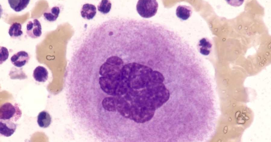 Células Sanguíneas: Megacariocito Granular