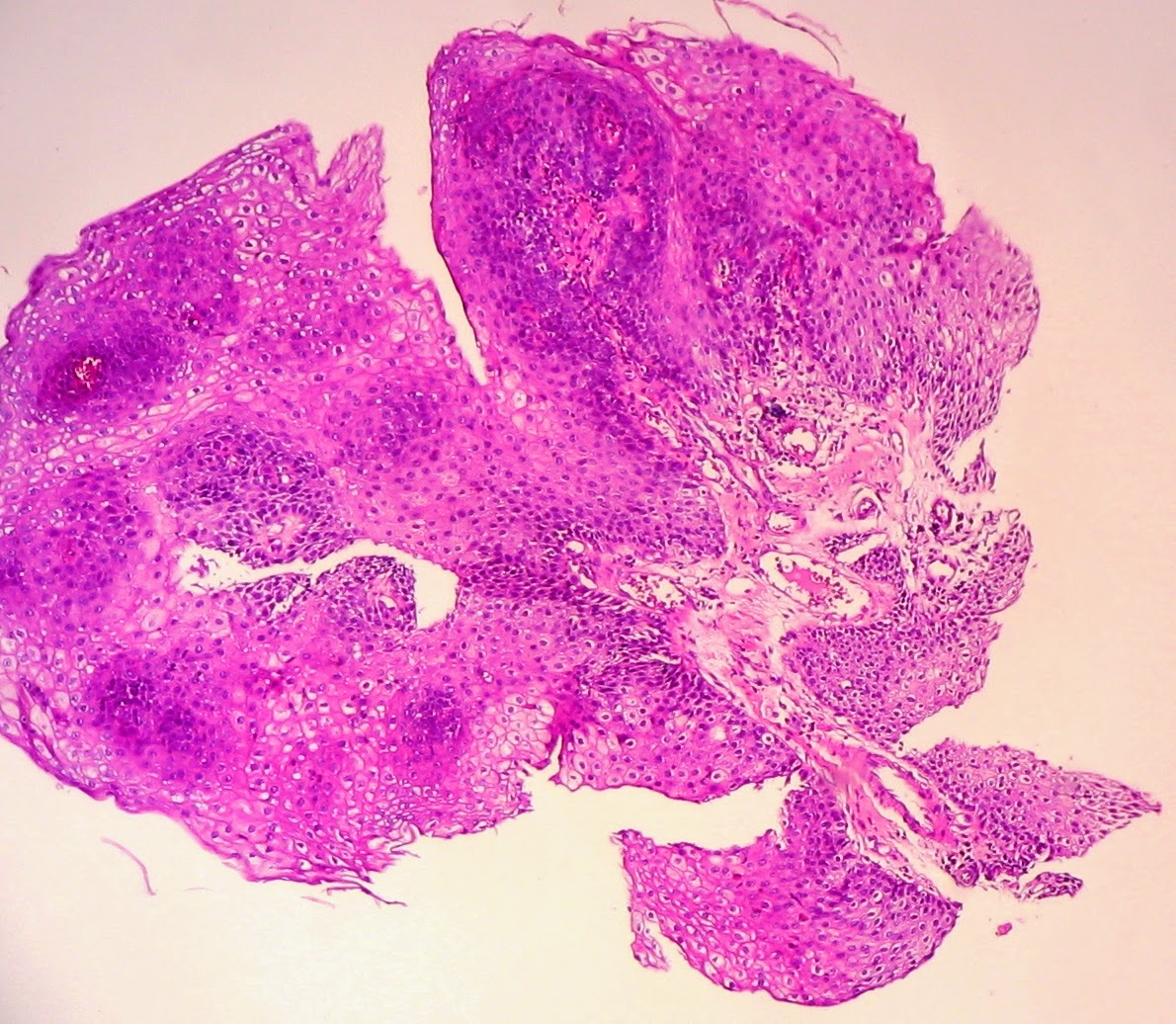 GASTROINTESTINAL AND LIVER HISTOLOGY PATHOLOGY ATLAS: ESOPHAGUS ...
