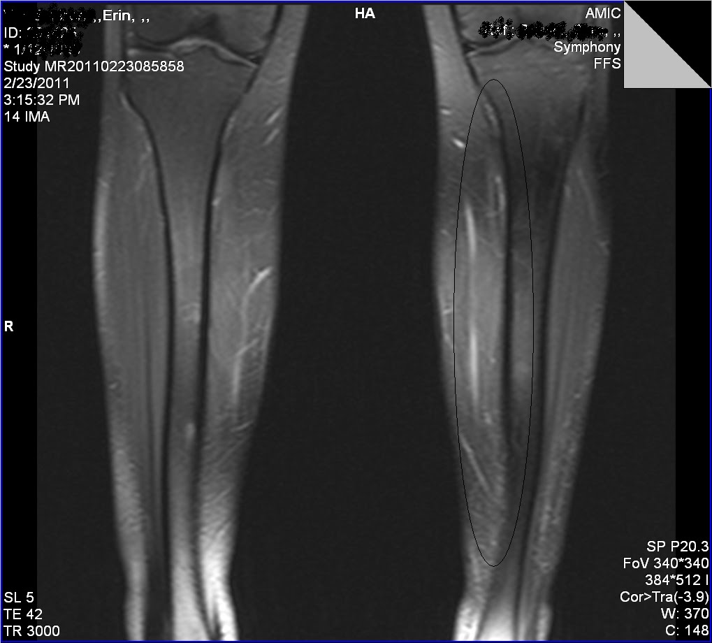 Eri-thon: From 0 to 26.2 in 30: February 2011