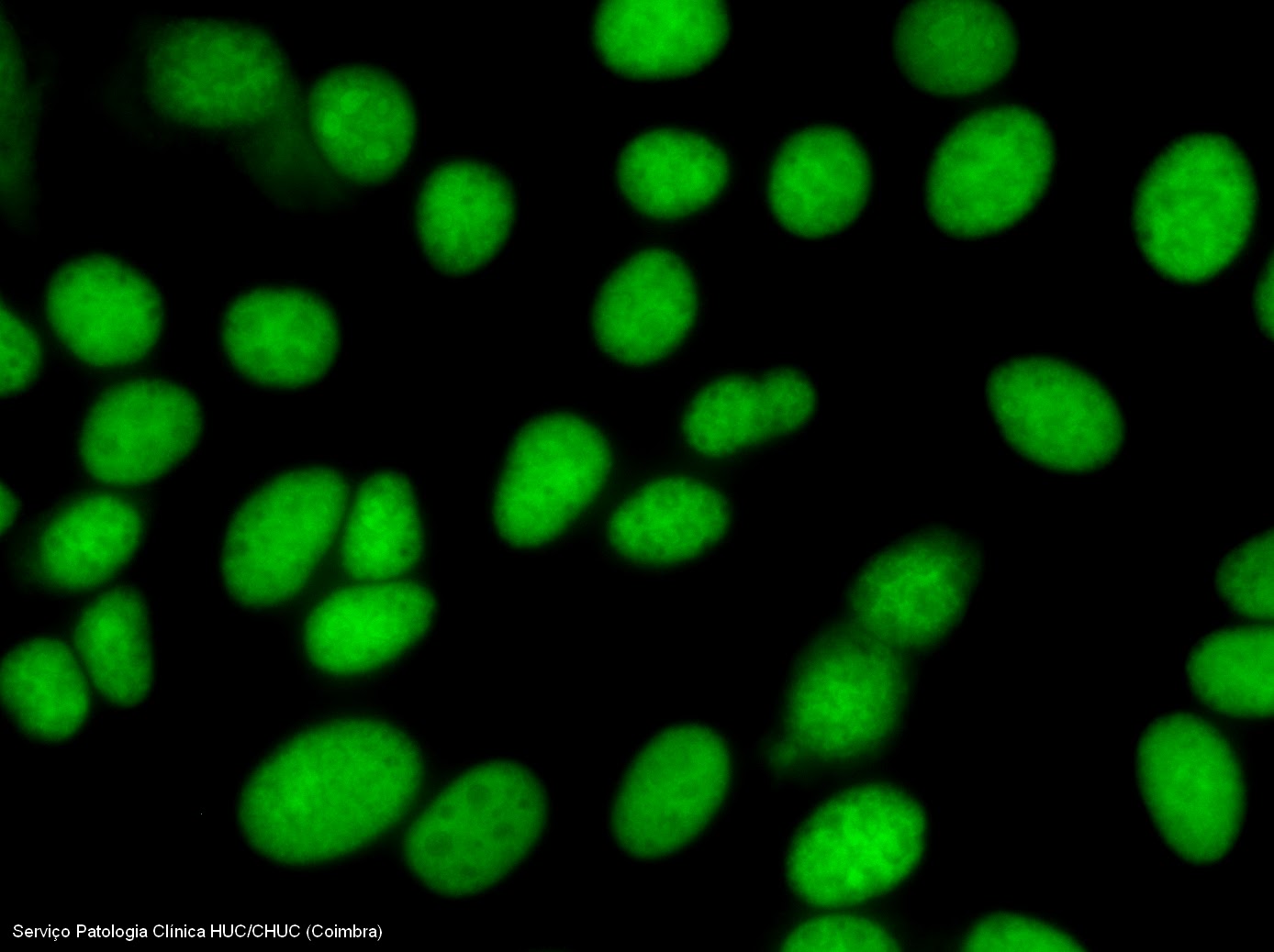 Anticorpos anti - Ku