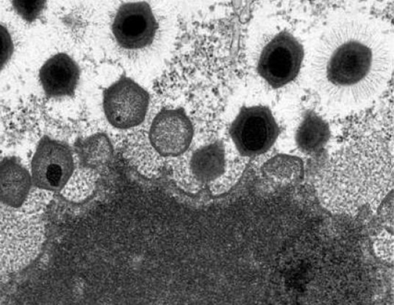 חיידקים, נגיפים, ושאר "ירקות" - בלוג של ביולוג - ד"ר דרור בר-ניר: נגיף ...