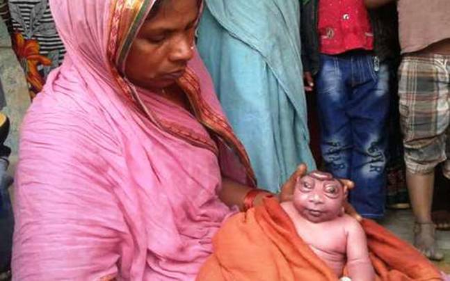 Arjunpuri in Qatar: Bihar woman refuses to accept baby born with ...