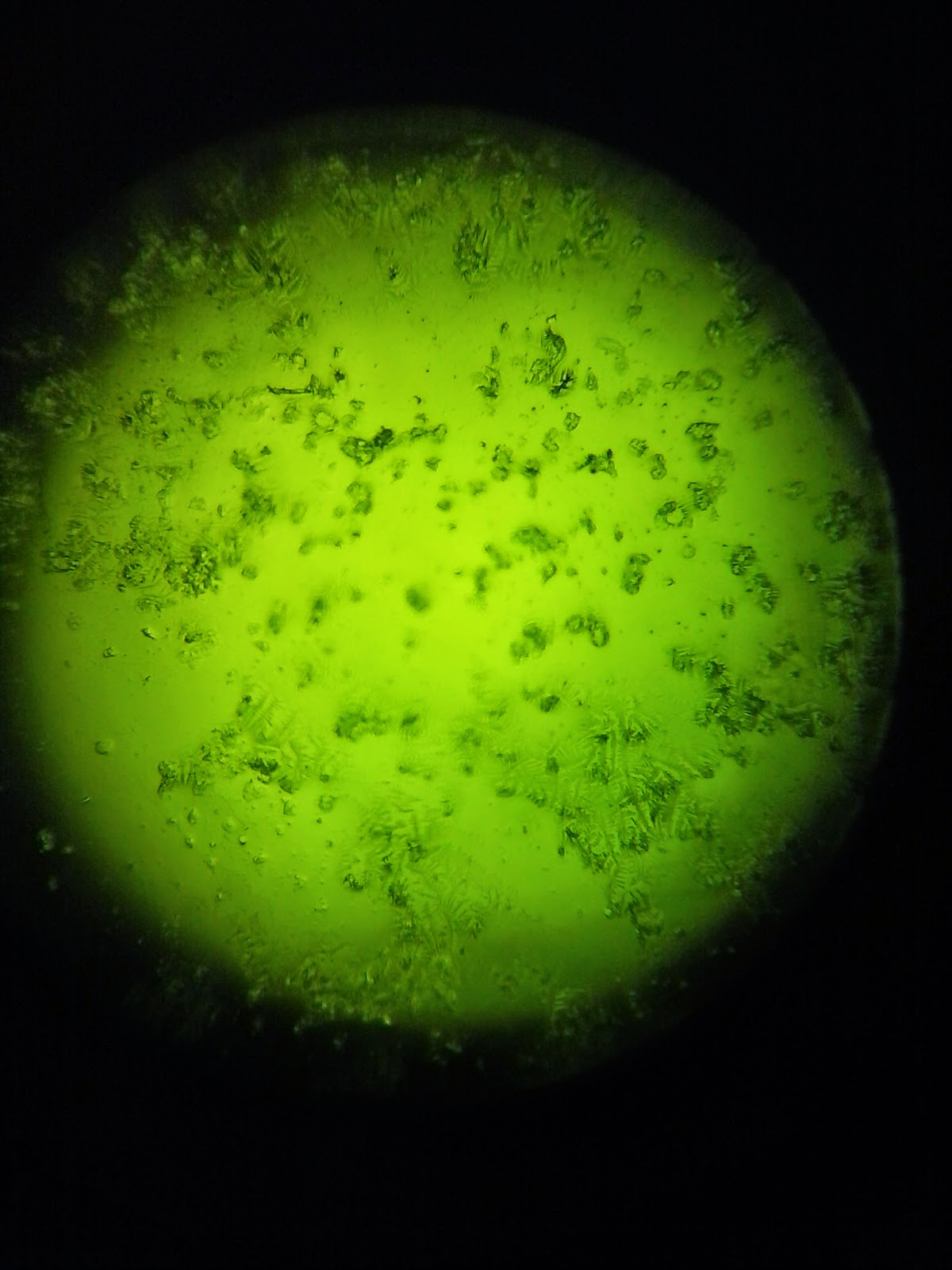 TTC with Saliva Microscope: Day by day ferning - Maybe Baby Saliva ...