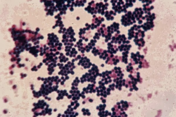 HicksMicro COURTESY Learning AID!: GRAM STAIN 8/22/22