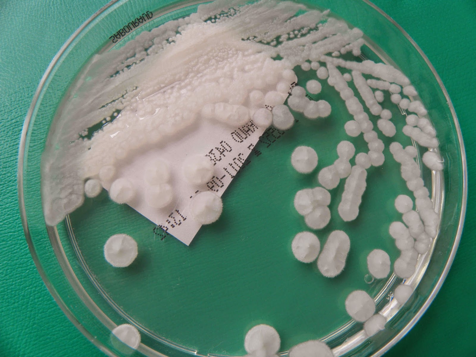 ATLAS MICOLOGIA: MAGNUSIOMYCES CAPITATUS