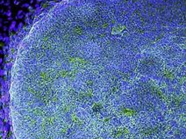 Células Madre: Células Madre