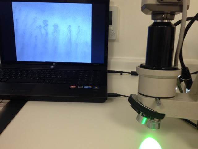 Raynauds Scleroderma Global Patients: Nailfold Capillaroscopy Equipment ...