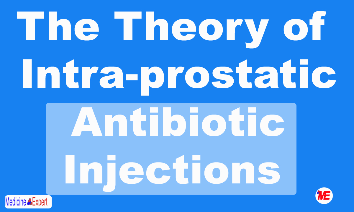 The Theory of Intra-prostatic Antibiotic Injections ~ Medicine Expert