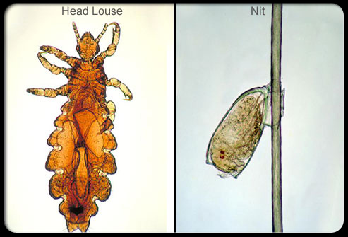 Fakta Kutu Di Sebalik Rambut Kita | V12gether