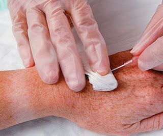 Discontinuing a Peripheral IV ~ Nursing