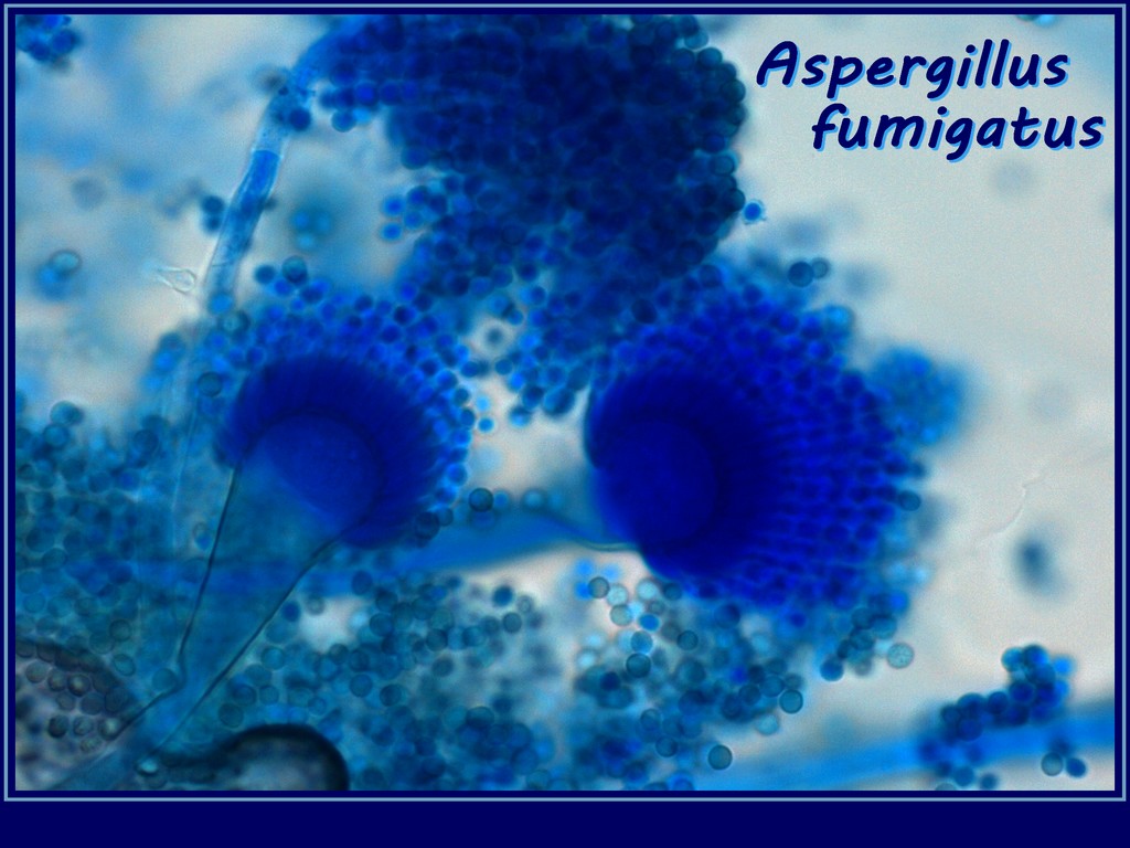 Fun With Microbiology (What's Buggin' You?): Aspergillus fumigatus