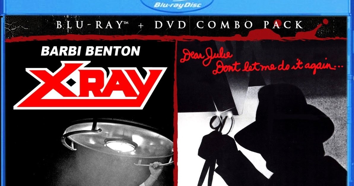 Barbi Benton Gets An X Ray From Klaus Kinskis Schizoid Review Cineventures