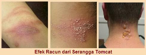 DHEKKAZONE: Serangga Tomcat - Racunnya Membuat Kulit Melepuh