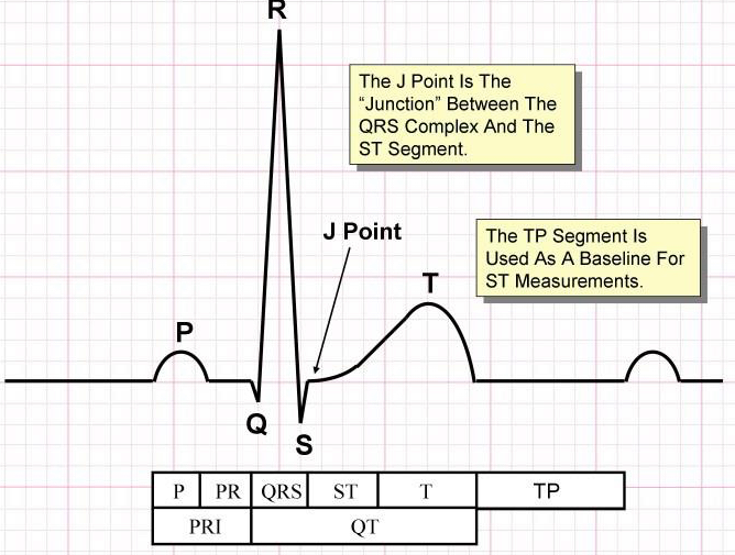 Chest Medicine Made Easy-Dr Deepu: ECG