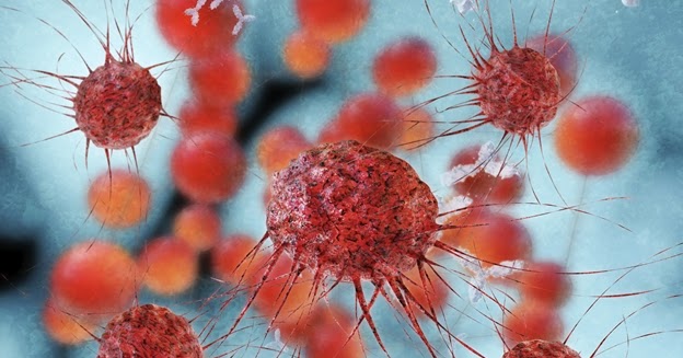 TodoNotas : ¿Cuáles son los agentes cancerígenos que nos rodean?