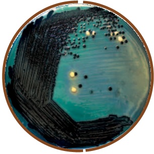 [Microbiology] Hektoen Enteric Agar | Free Medical Atlas