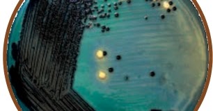 [Microbiology] Hektoen Enteric Agar | Free Medical Atlas