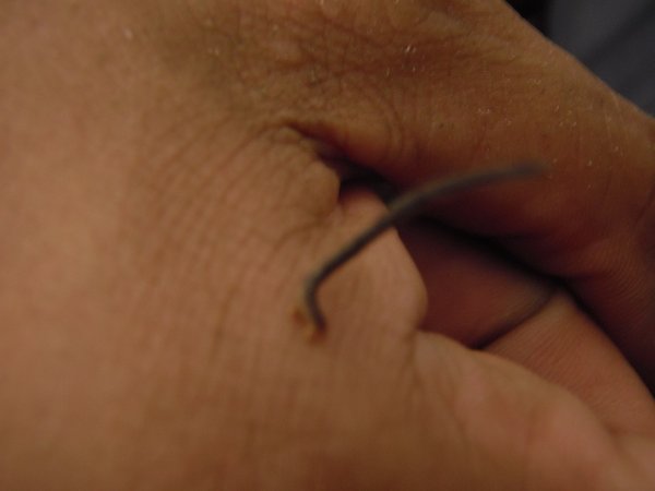 Akyatera Bundokera: Bloody Hell! : Limatik Encounters