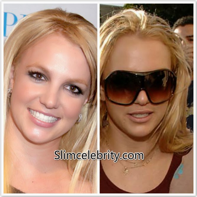 Britney Spears Plastic Surgery Breast Implants Nose Job Lips Before And After Pictures