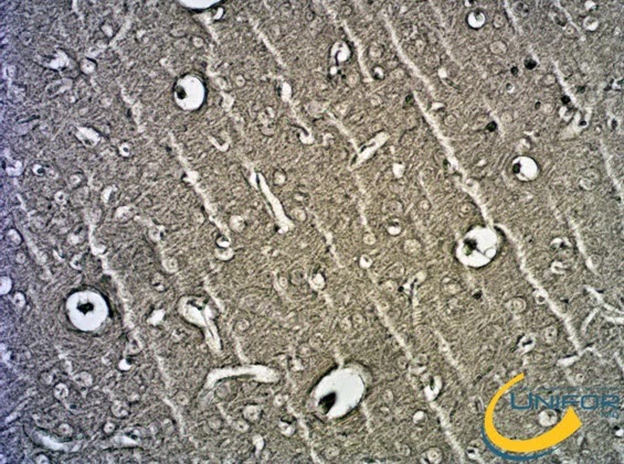 Atlas Histológico UNIFOR-MG: Micróglia